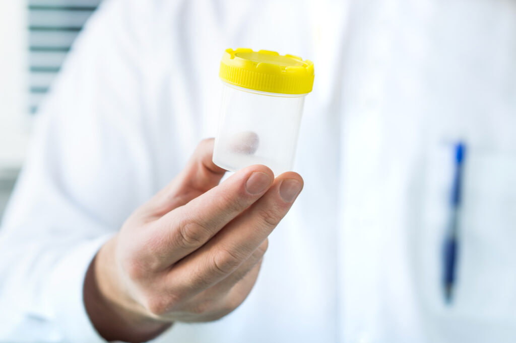 Male Infertility Testing, Diagnosis & Treatment | Pinnacle Fertility